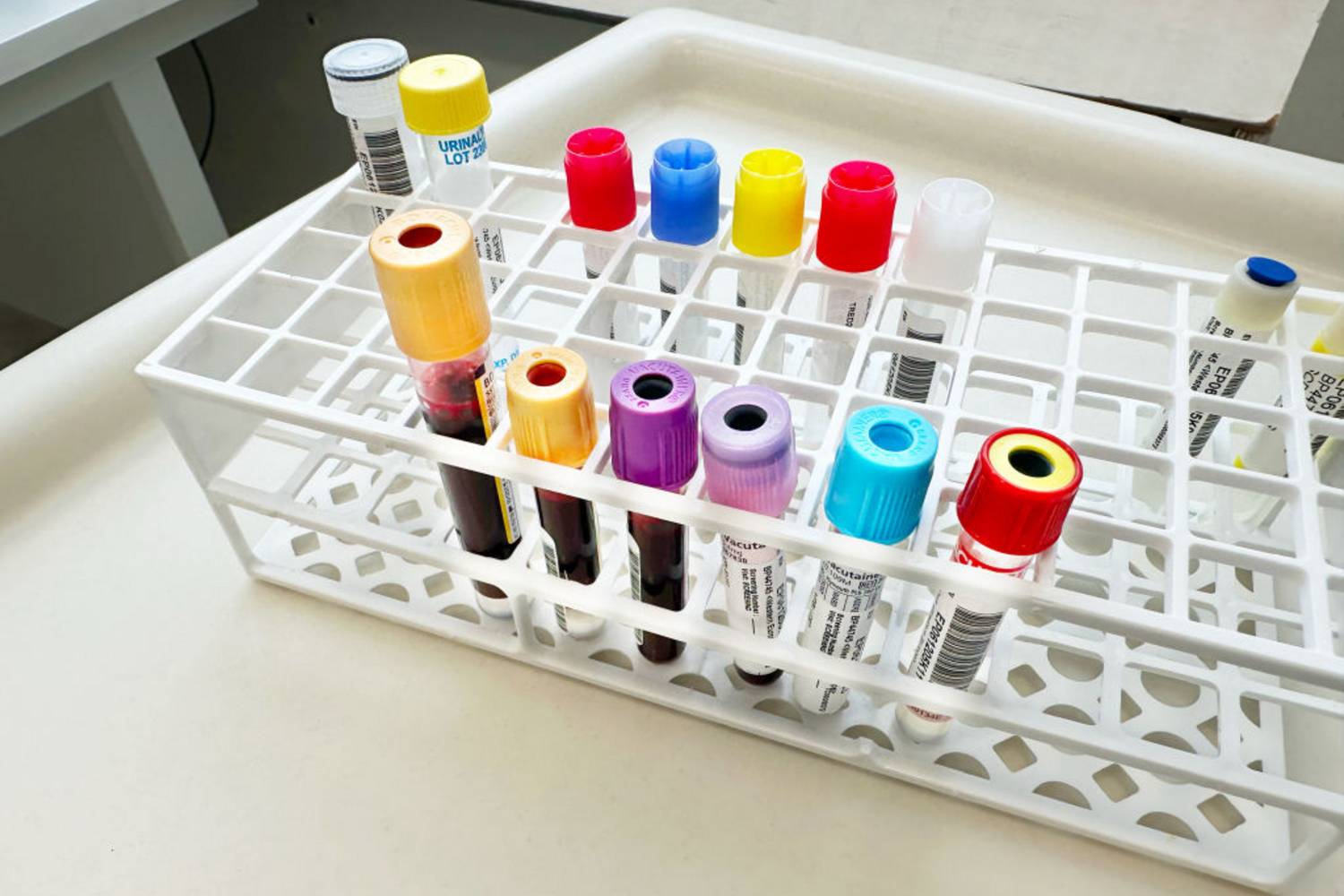 30 ezret spórolhatsz, ha ebből a 6-ból valamelyik igaz rád: kevesen ...