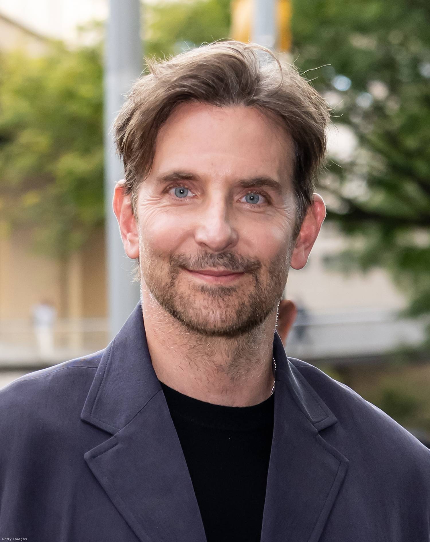 Bradley Cooper így megváltozott plasztikai beavatkozásai után: szakértő ...